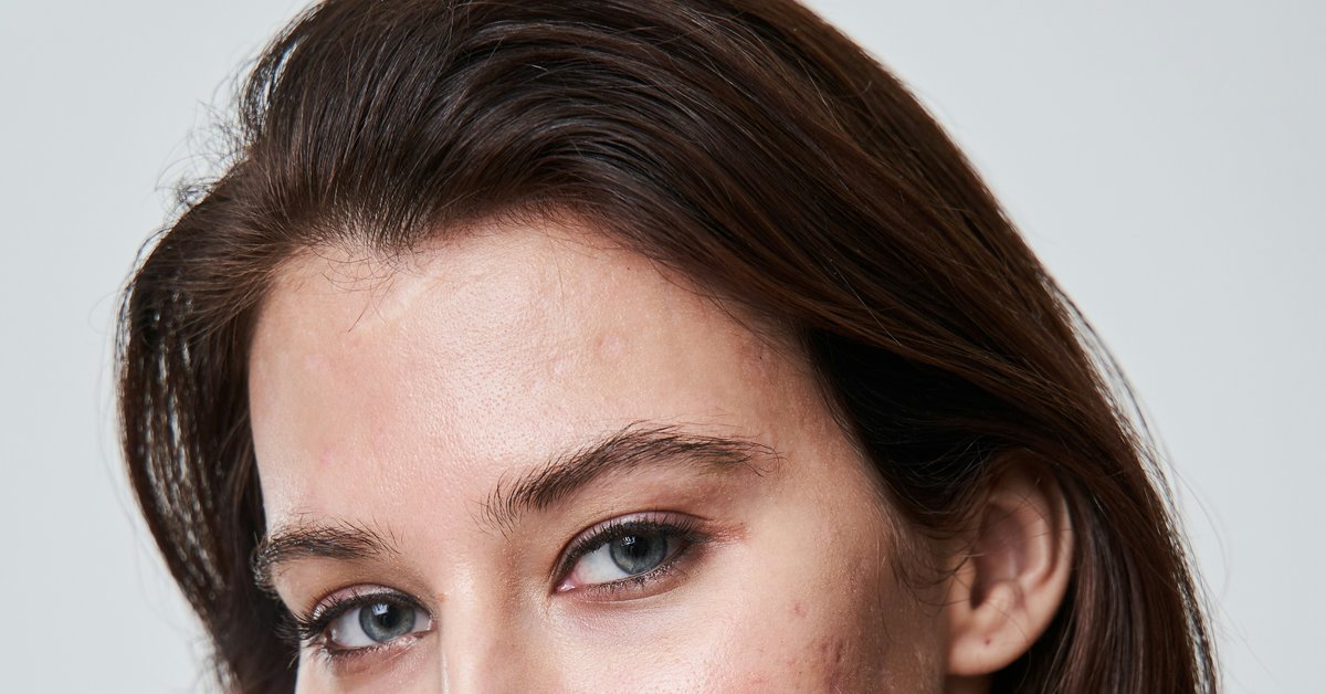 Pickel | Beautypedia